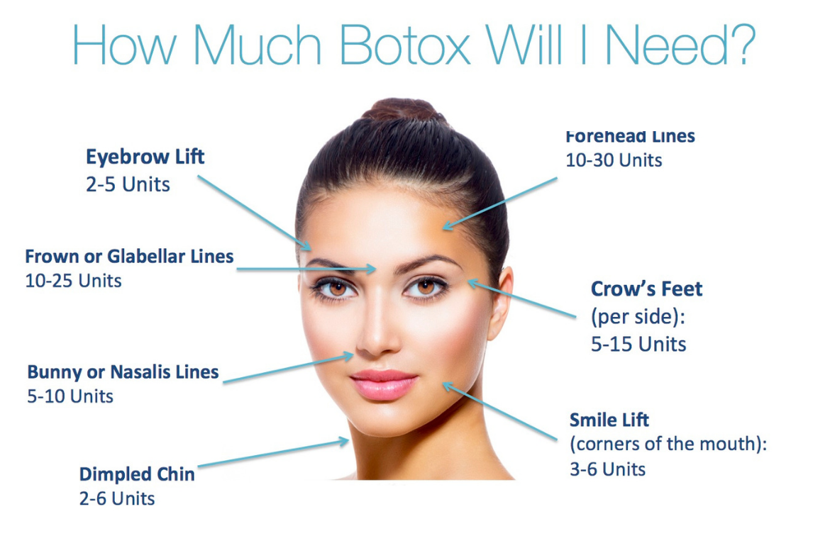 Botox – Cloud 9 Medi Spa